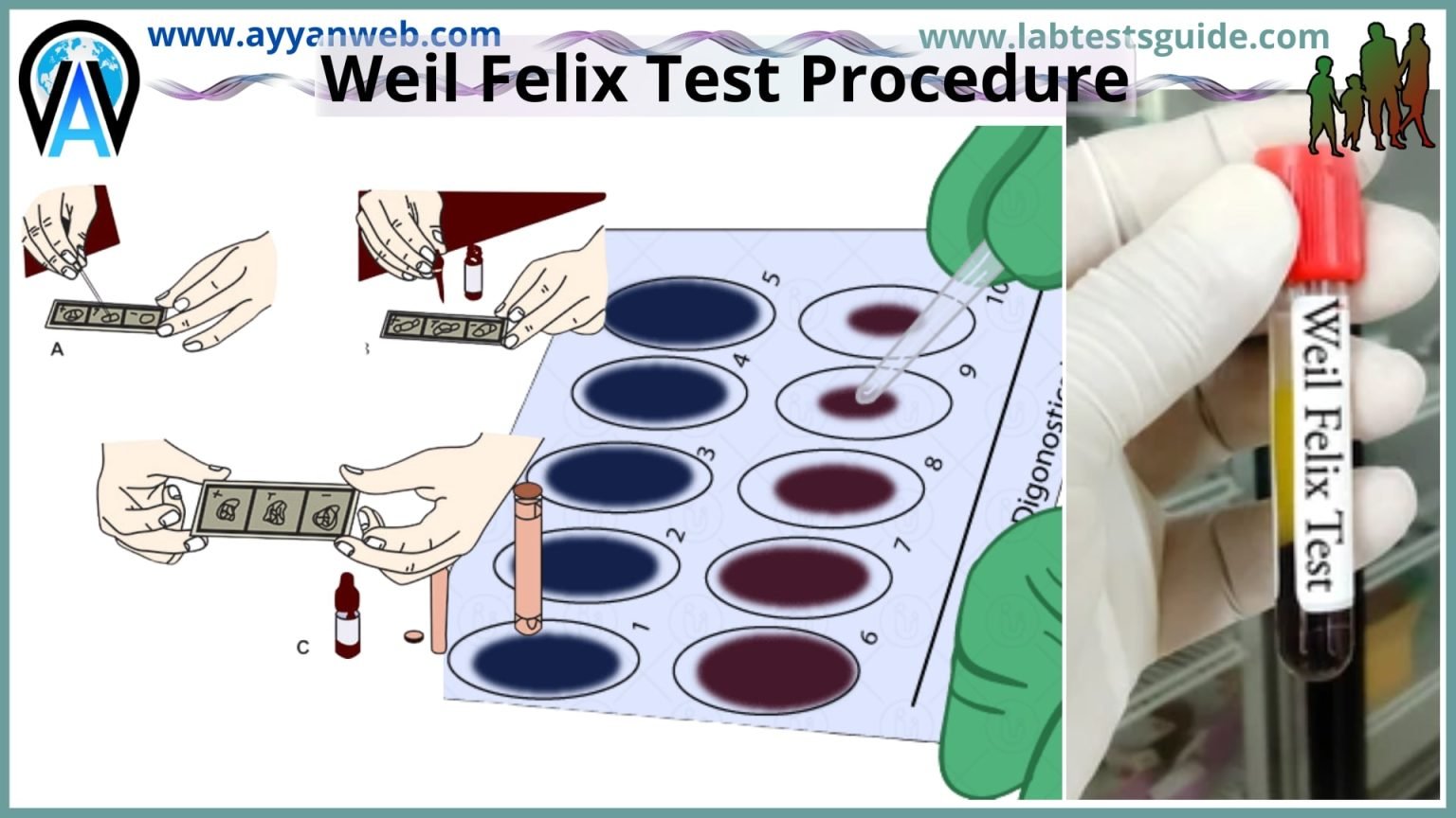 Test Procedures | Lab Tests Guide