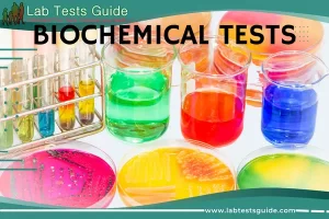 Biochemical Tests Purpose, Procedure And Results | Lab Tests Guide