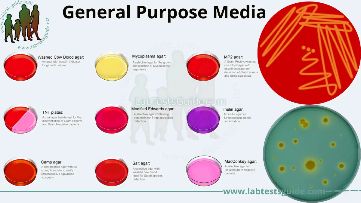 Types Of Culture Media: Differential, Selective And, 42% OFF Types Of Culture Media: Differential, Selective And, 42% OFF