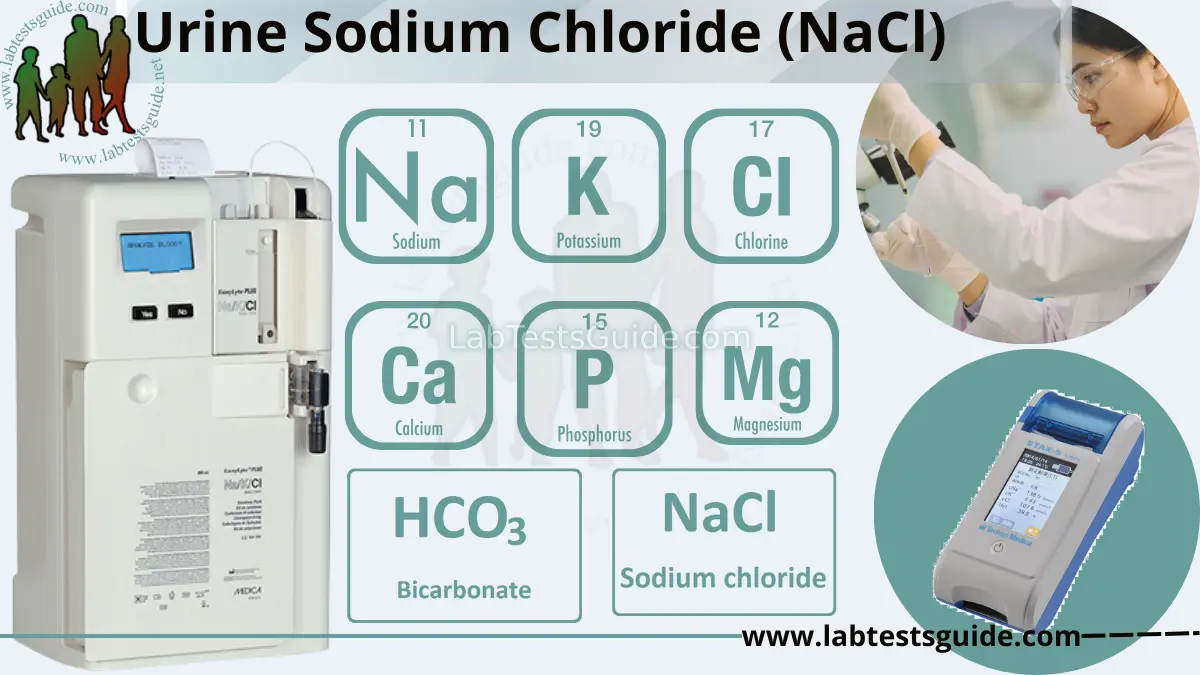 Urine Sodium Chloride (NaCl) Ratio | Lab Tests Guide