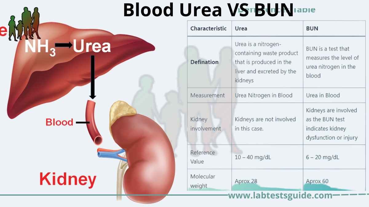 Urea In Urine Low Urea In Urine Low