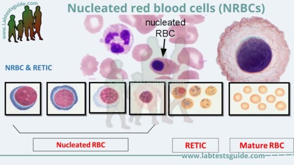 Nucleated red blood cells (NRBCs) | Lab Tests Guide