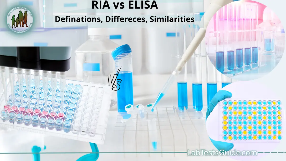 Difference Between RIA and ELISA | Lab Tests Guide