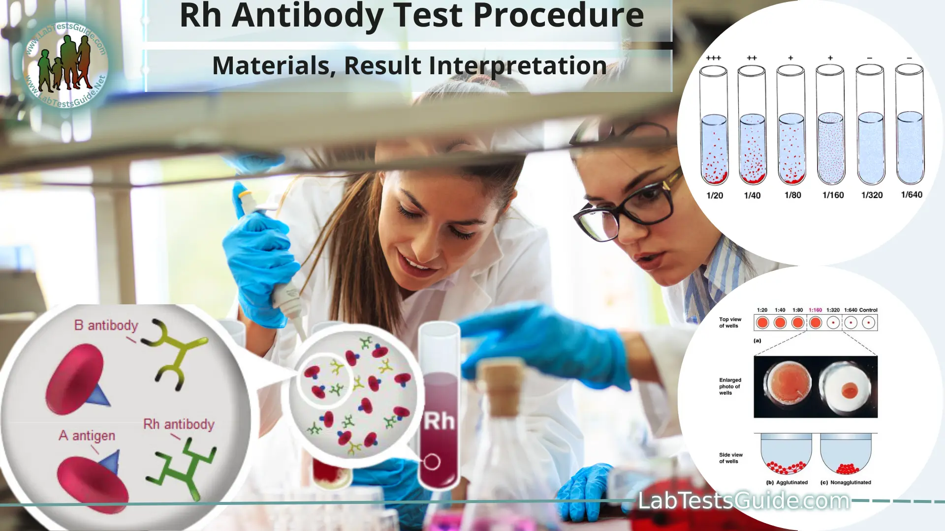 Rh Antibody Titre Test Procedure, Result Interpretation and more