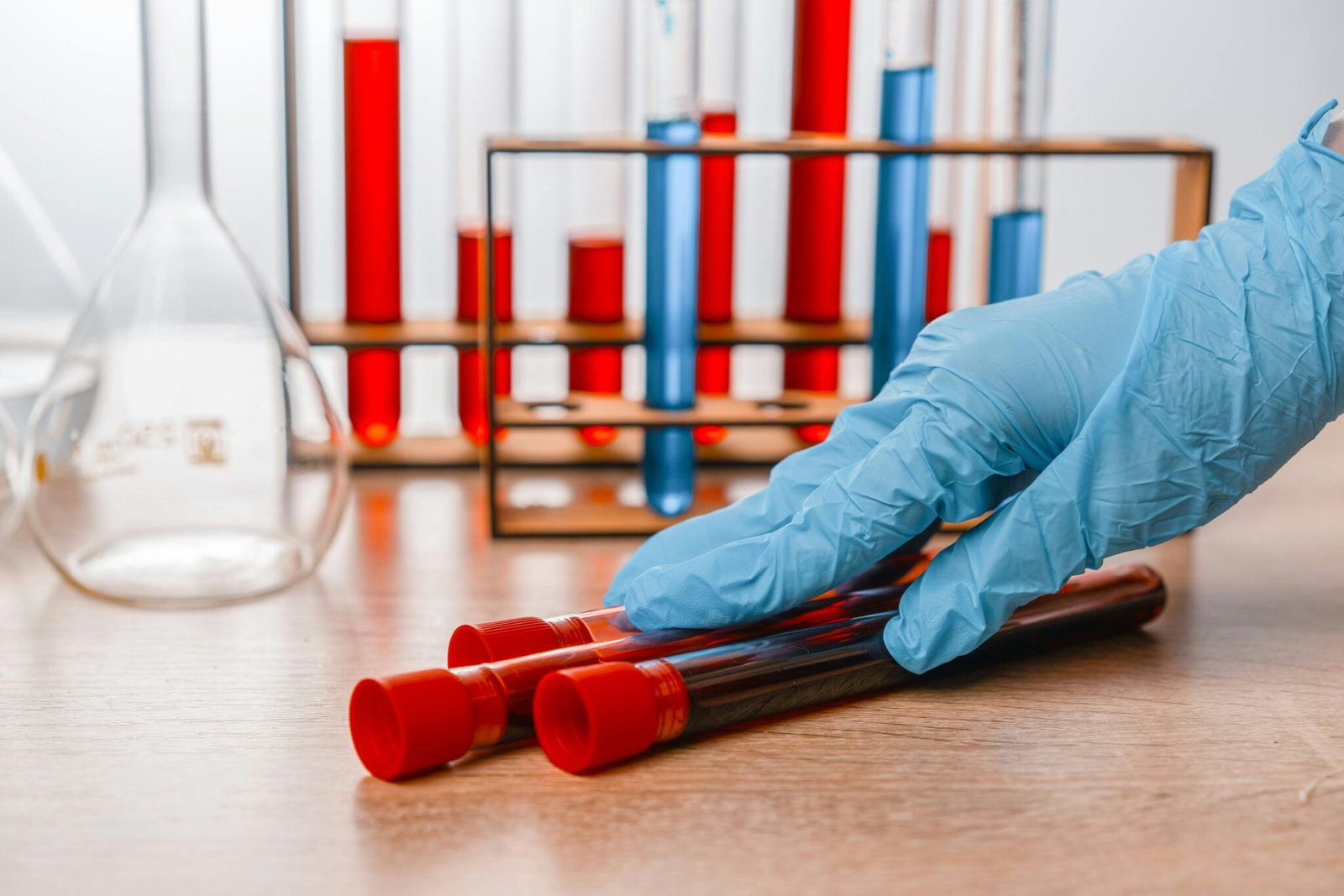 Understanding Biochemical Tests: Essential Tools for Health Assessment ...