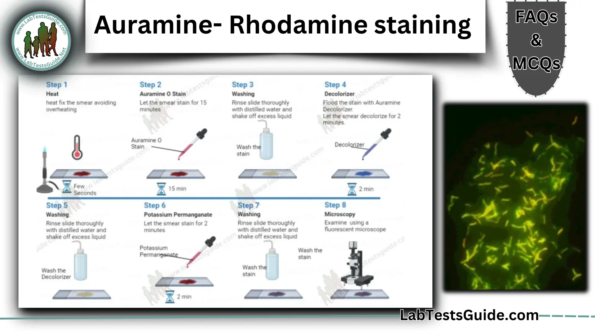 Auramine- Rhodamine Staining 50 FAQs and 30 MCQs