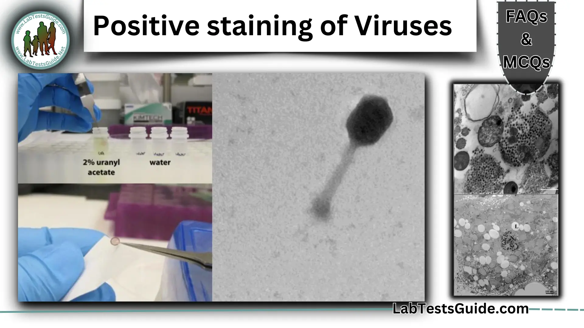 Positive staining of Viruses 50 FAQs and 30 MCQs
