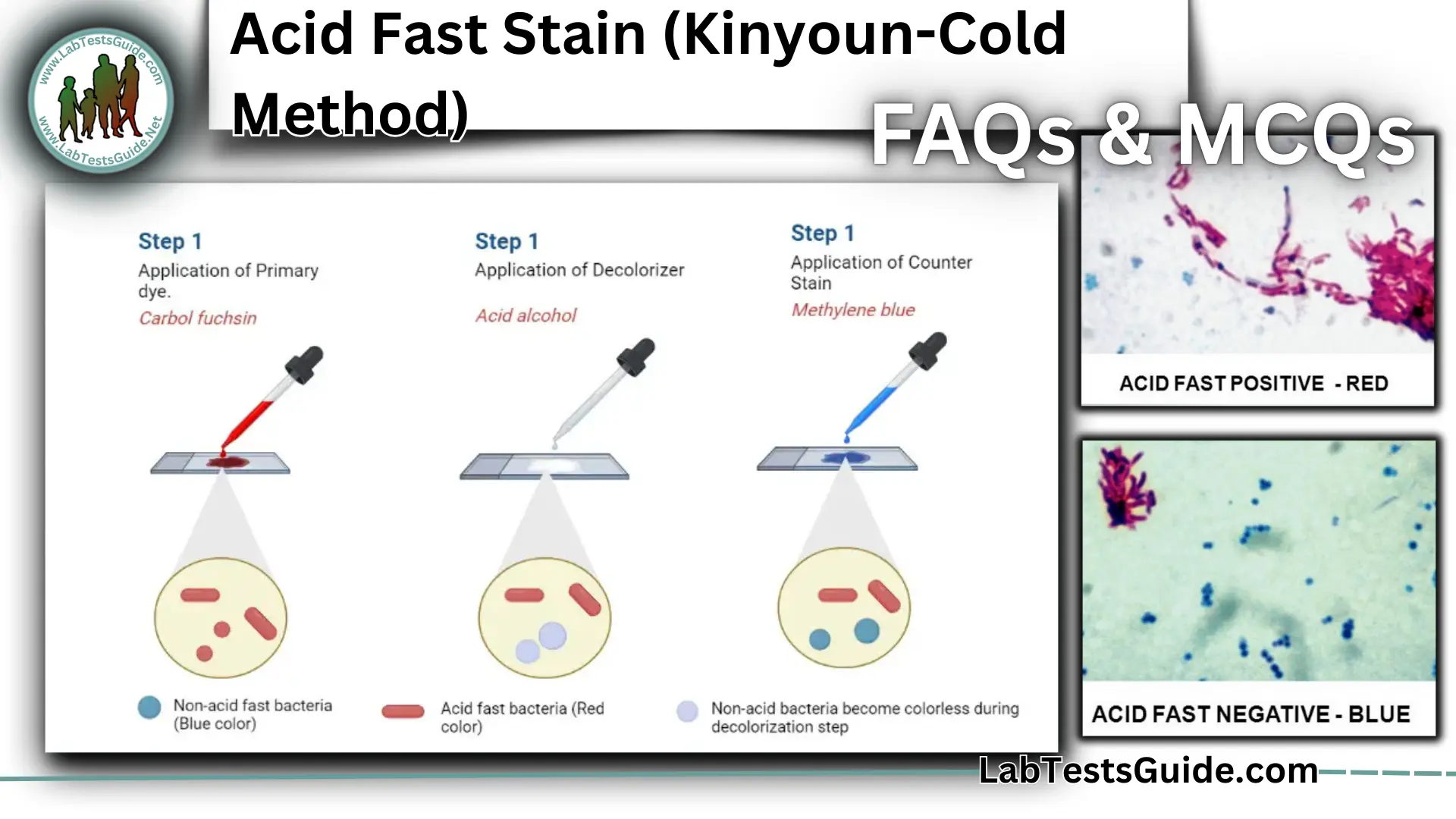 Acid Fast Stain (Kinyoun-Cold Method) 50 FAQs and 30 MCQs | Lab Tests Guide