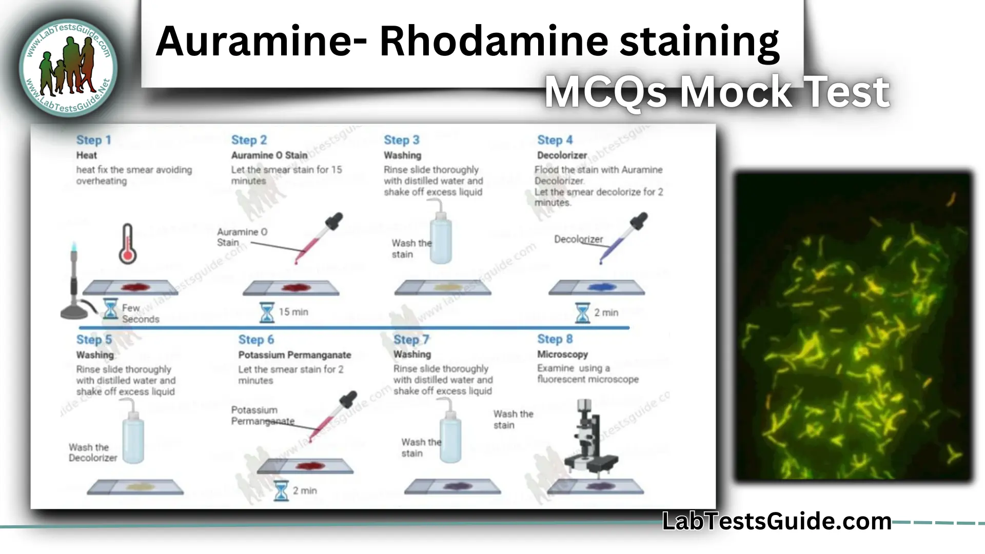 Auramine- Rhodamine Staining MCQs Mock Test (30 MCQs) | Lab Tests Guide
