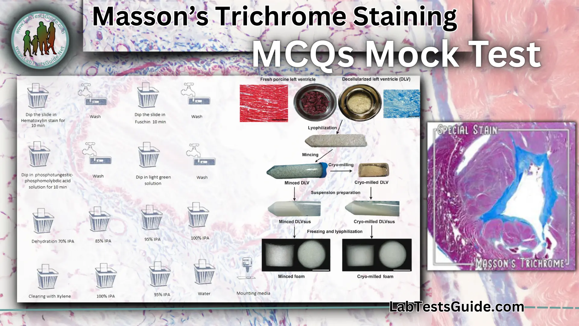 Masson’s Trichrome staining MCQs Mock Test (30 MCQs) | Lab Tests Guide