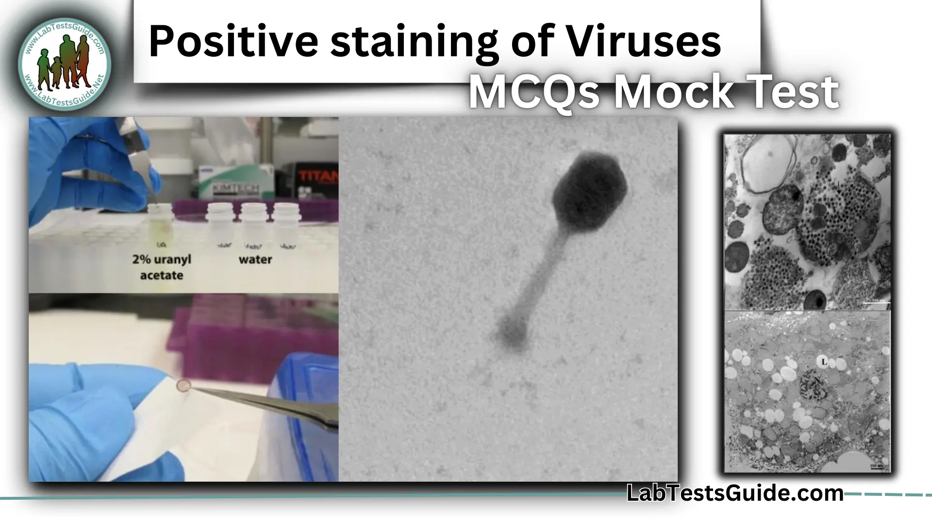 Positive Staining of Viruses MCQs Mock Test (30 MCQs) | Lab Tests Guide