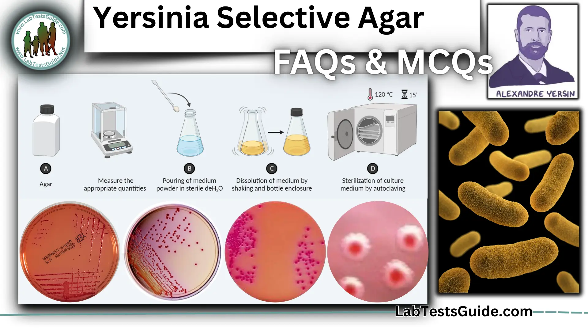 Yersinia Selective Agar 50 FAQs and 30 MCQs | Lab Tests Guide