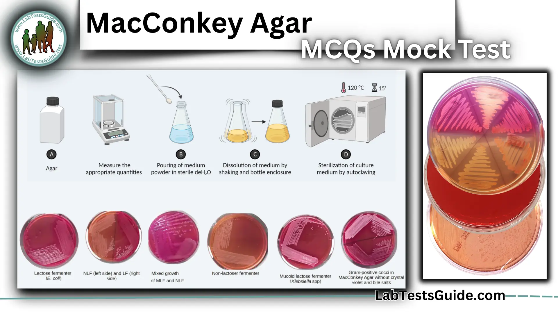MacConkey Agar – 30 MCQs Mock Test for Microbiology & Lab Professionals