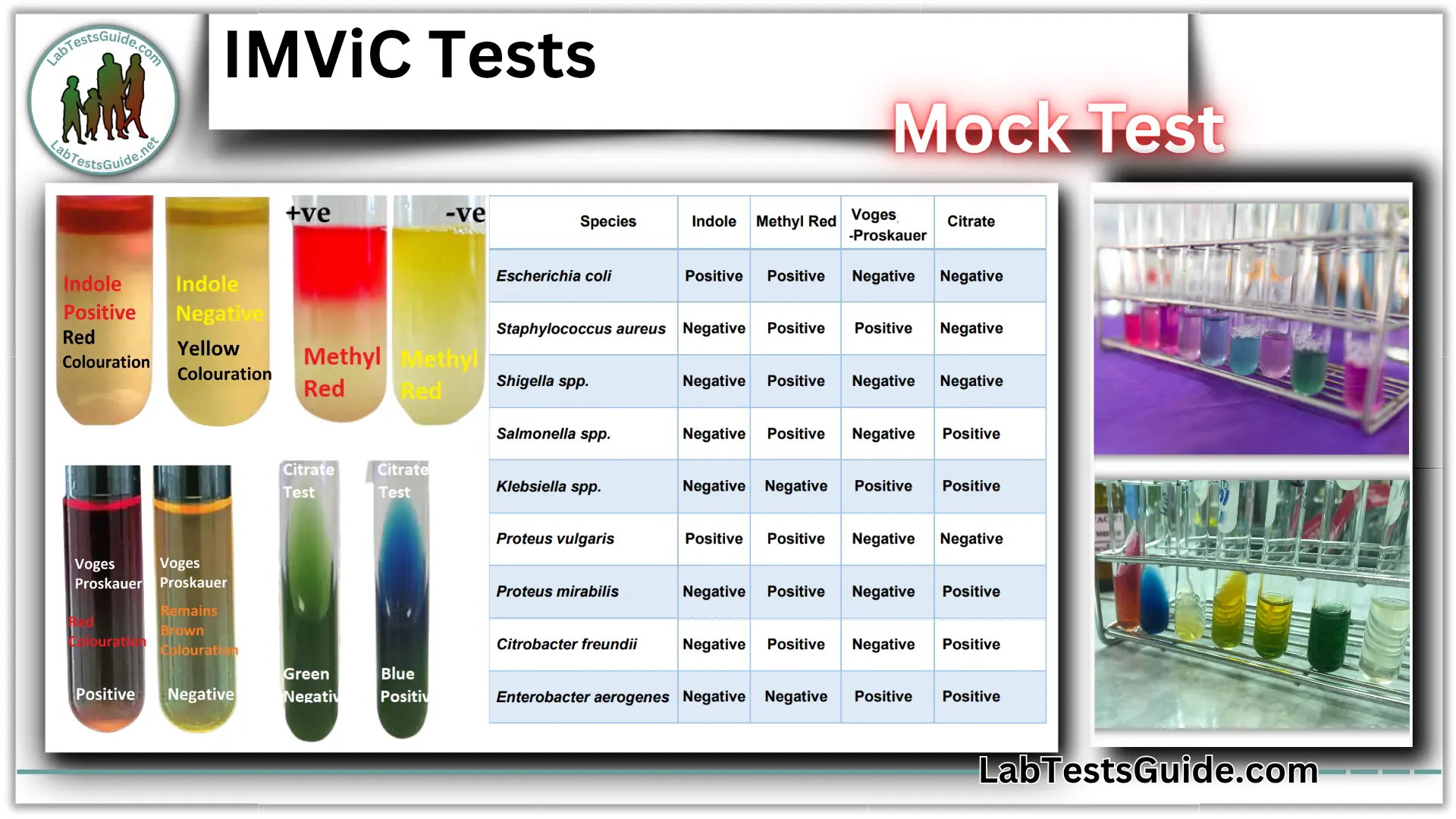 IMViC Test MCQs Mock Test | Lab Tests Guide