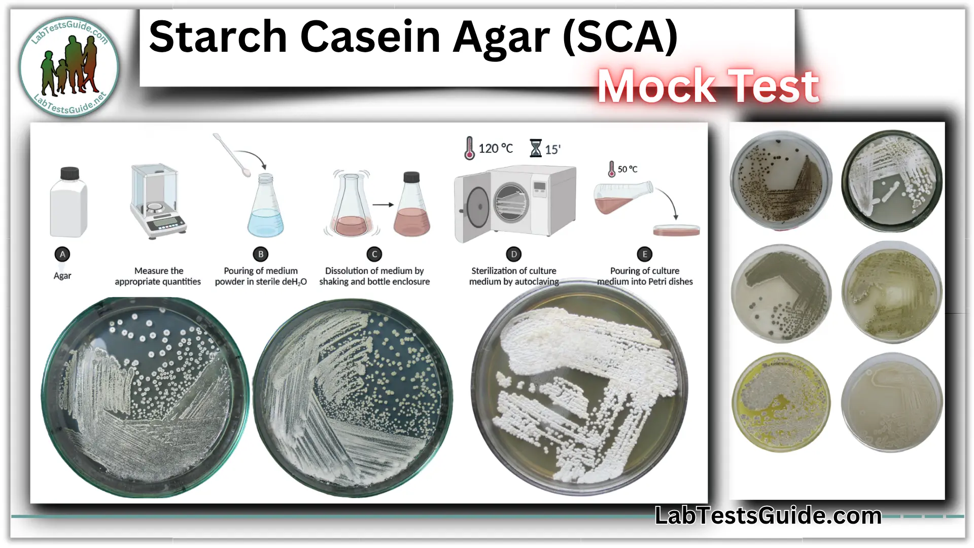 Starch Casein Agar (SCA) MCQs Mock Test | Lab Tests Guide